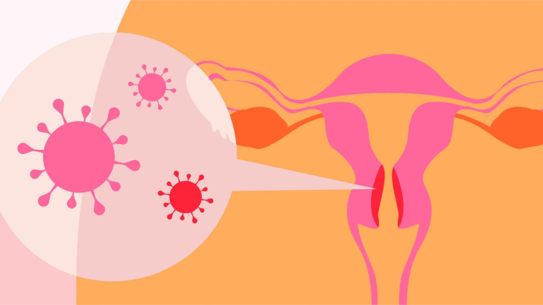 HPV: Früherkennung rettet Leben